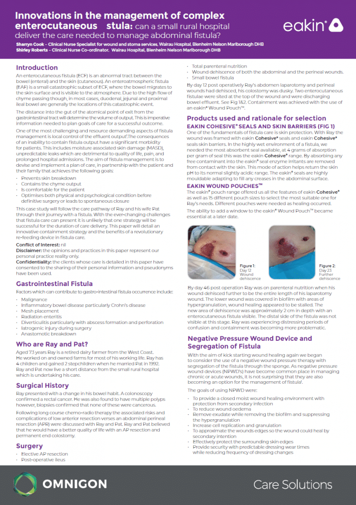 Innovations in the management of complex enterocutaneous fistula | Omnigon
