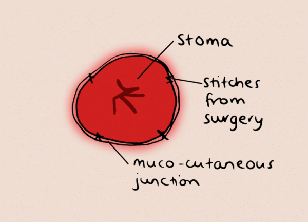 What is a Muco-cutaneous junction? | Omnigon